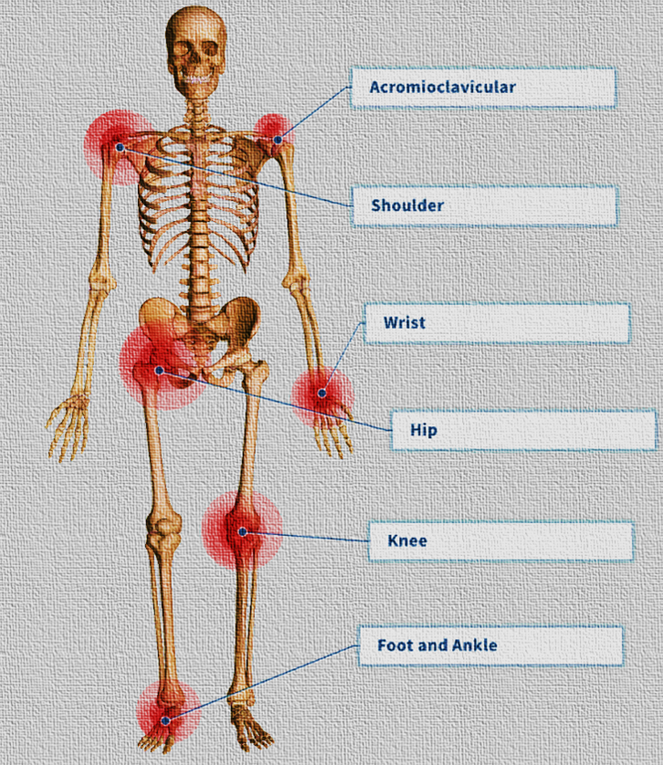 Terminology in Physiotherapy
