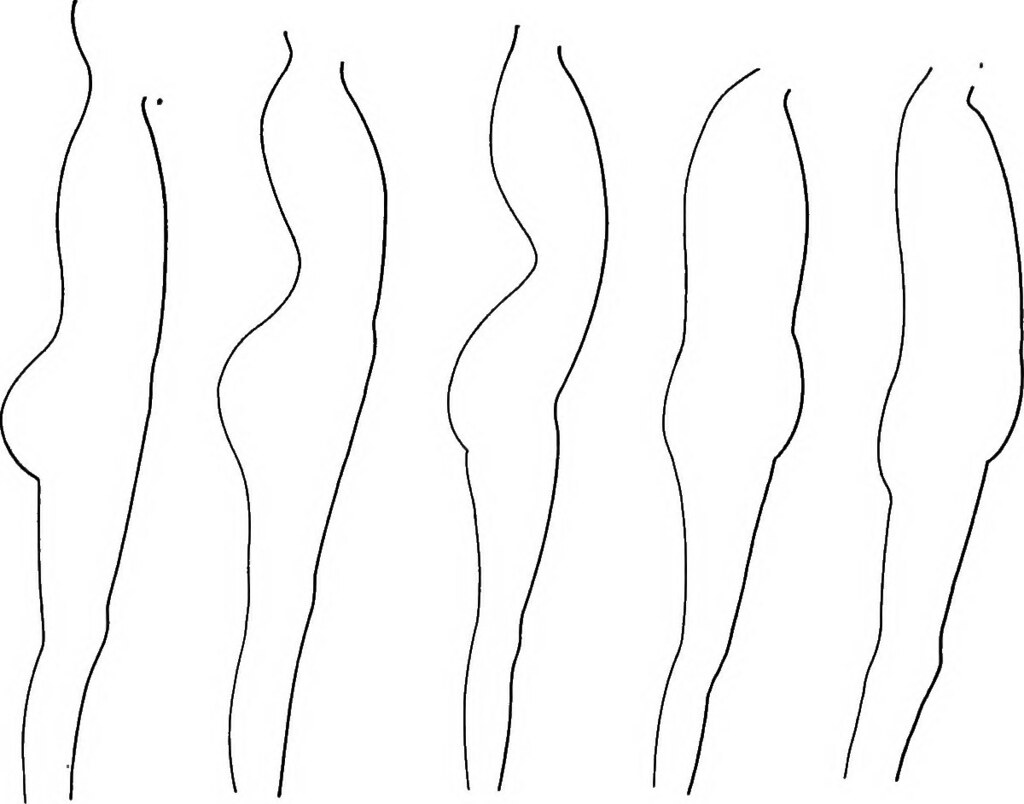 Terminology in Physiotherapy